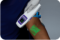 AccuVein Vein Visualization-Improves IV 1-Stick Success 3.5x